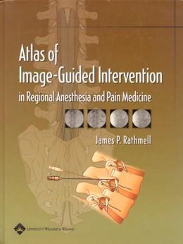 Atlas of image-guided intervention in regional anesthesia and pain ...
