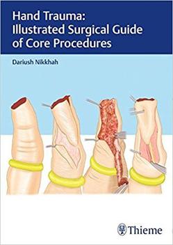 Hand trauma: illustrated surgical guide of core procedures - Thieme ...