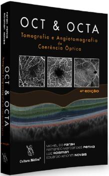Oct & Octa Tomografia E Angiotomografia De Coerência Óptica - Cultura ...