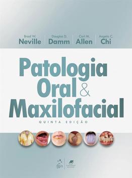 Patologia Oral E Maxilofacial, Autor: Veville, Brad W./ Damm, Douglas D./ Allen, Carl M./ Chi ...