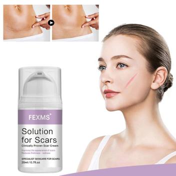 Pomada para Cicatrizes e Marcas de Acne Light Scar - 20ml - Kit de ...