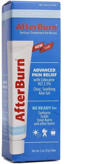 After Burn Pomada Calmante Para tratamento de Queimadura em Gel - 57g ...