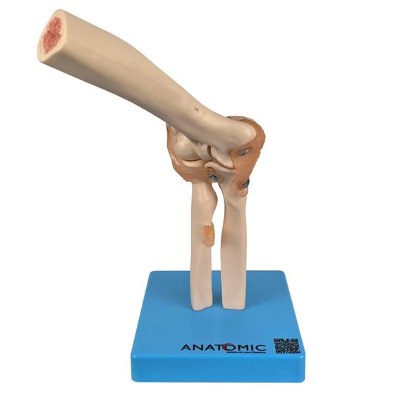 Articulação do Cotovelo com Ligamentos - ANATOMIC - Modelos Anatômicos ...