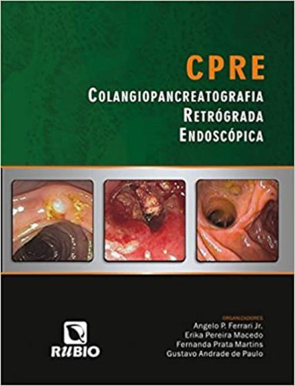 CPRE – Colangiopancreatografia Retrógrada Endoscópica - Rubio - Livros ...