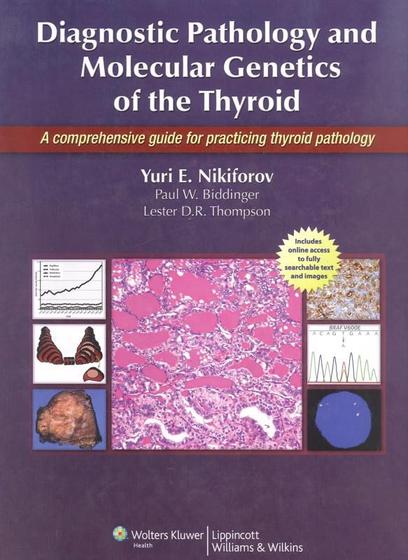 DIAGNOSTIC PATHOLOGY AND MOLECULAR GENETICS OF THE THYROID - - Livros de Medicina - Magazine Luiza