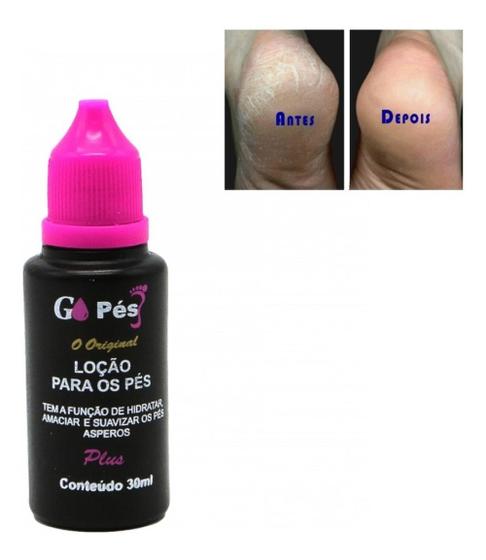 Go Pés Plus Loção Hidratante Para Rachaduras E Calos Nos Pés - Suportt ...