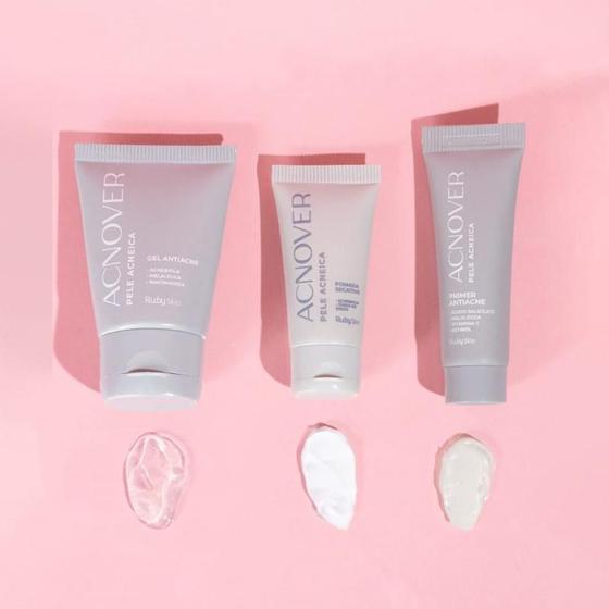 Kit Antiacne Acnover - Primer, Gel e Pomada Secativa - Ruby Rose ...