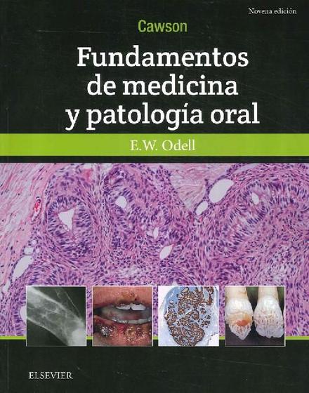 LIVRO FUNDAMENTOS DE MEDICINA Y PATOLOGÍA ORAL CAWSON DE Edw - - Livros ...