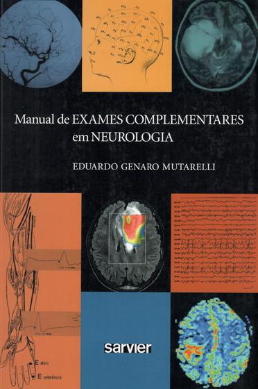 Livro - Manual de exames complementares em Neurologia - Livros de Medicina - Magazine Luiza