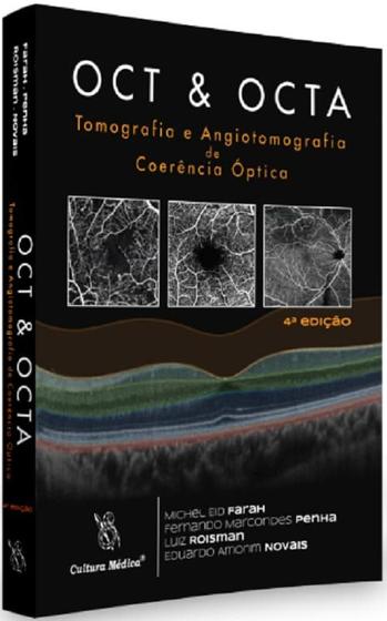 Oct & Octa Tomografia E Angiotomografia De Coerência Óptica - Cultura ...