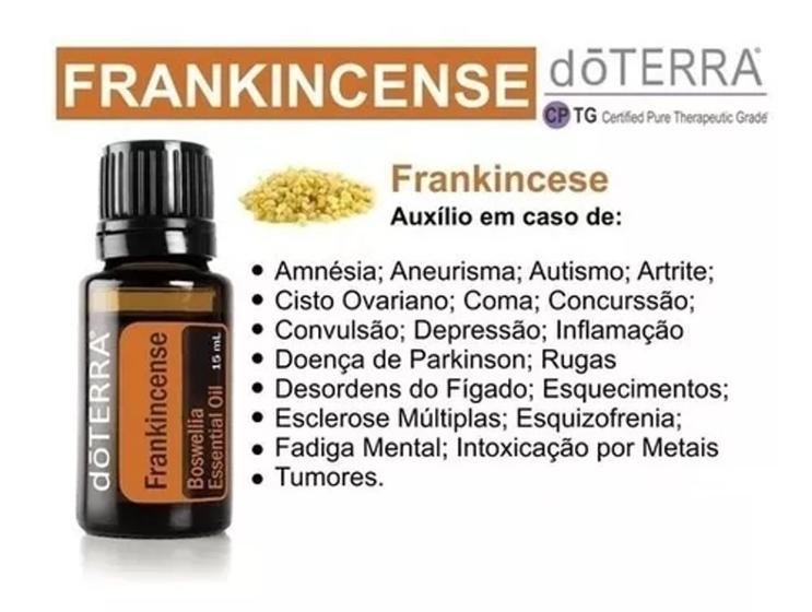 Óleo Essencial FrankIncense doTERRA 15ml - Óleos Essenciais - Magazine ...