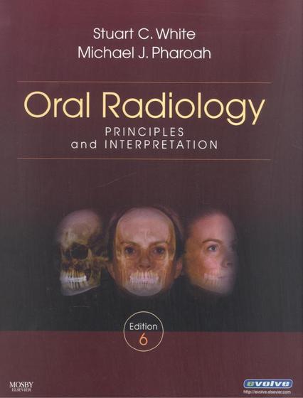 Oral radiology - principles and interpretation - 6th ed - Mos - mosby ...