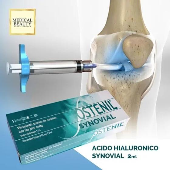 Ostenil Acido Hialuronico Synovial 2ml - Cuidados com o Rosto ...