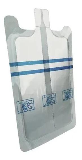 Placa Eletrocirúrgica Bluepad - Adulto/Pediátrico - Mod AP20 - Material ...