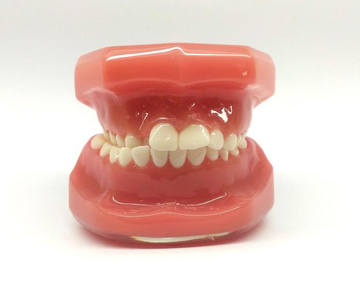 Rd-041 pediatria dentição mista classe iii mordida cruzada - rosa ...