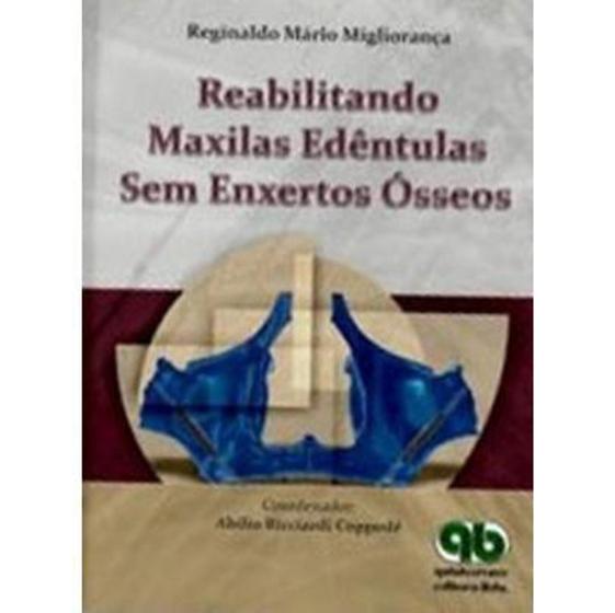 Reabilitando Maxilas Atróficas Edêntulas Sem Enxertos Ósseos ...