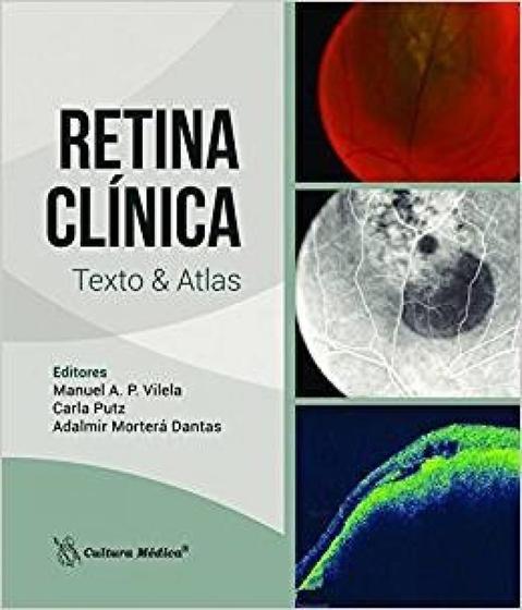 Retina clinica: texto e atlas - Atlas - Magazine Luiza