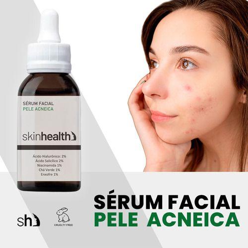Sérum Alta Eficacia Anti-acne Mix 5 Ativos 60ml - Skinhealth - Outros ...