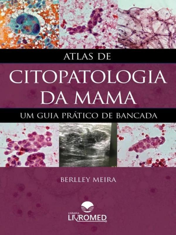 Atlas de citopatologia da mama - LIVROMED PAULISTA - Atlas - Magazine Luiza