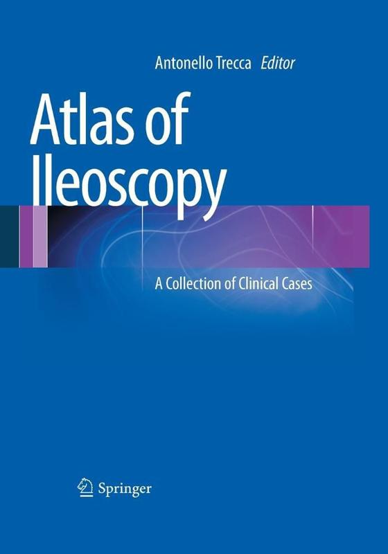 Atlas of Ileoscopy - Springer Nature - Mapas e Atlas - Magazine Luiza