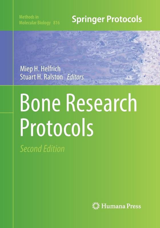 Bone Research Protocols - Boné - Magazine Luiza