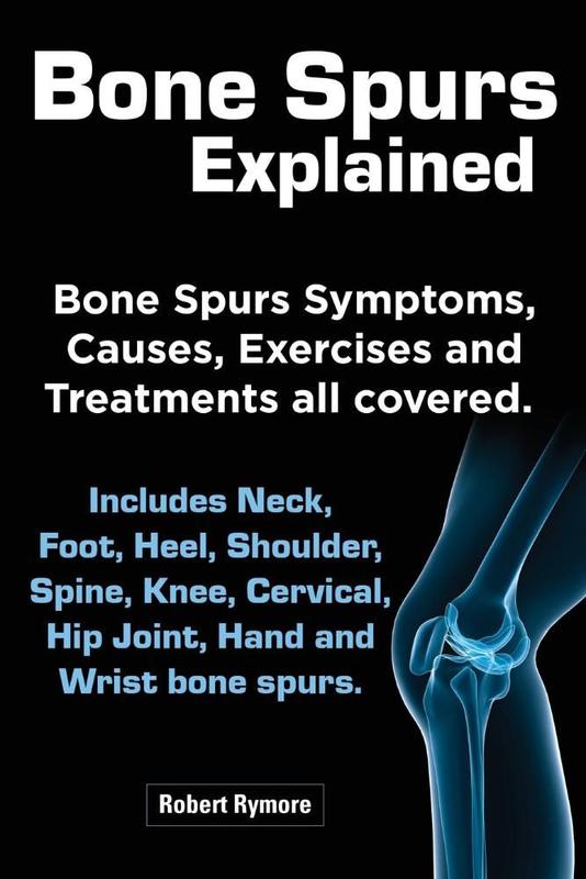 Bone Spurs Explained Bone Spurs Symptoms Causes Exercise Livros