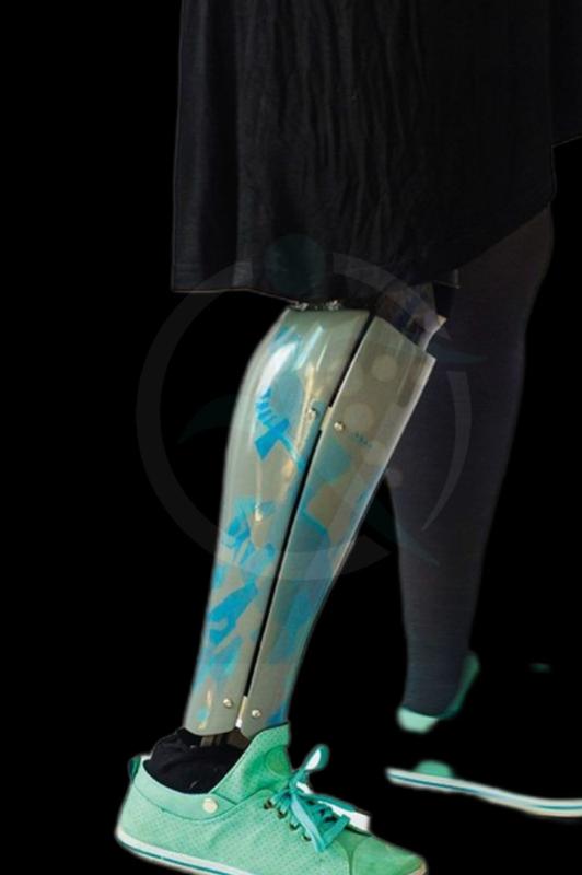 Capa prótese transtibial X transfemoral - Ortophs - Acessibilidade e ...