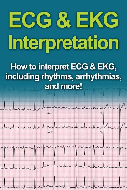 ECG & EKG Interpretation - Ingram Publishing - Livros de Comunicação ...