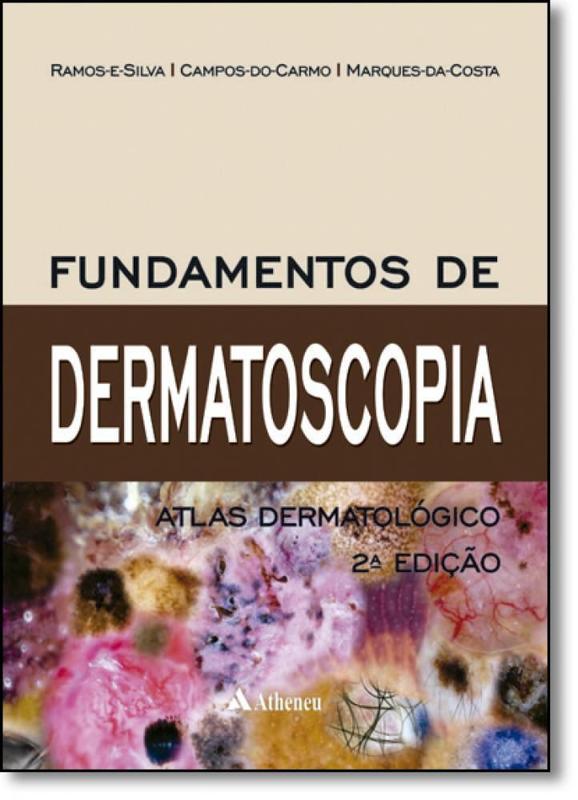 Fundamentos de Dermatoscopia: Atlas Dermatologico - Mapas - Magazine Luiza