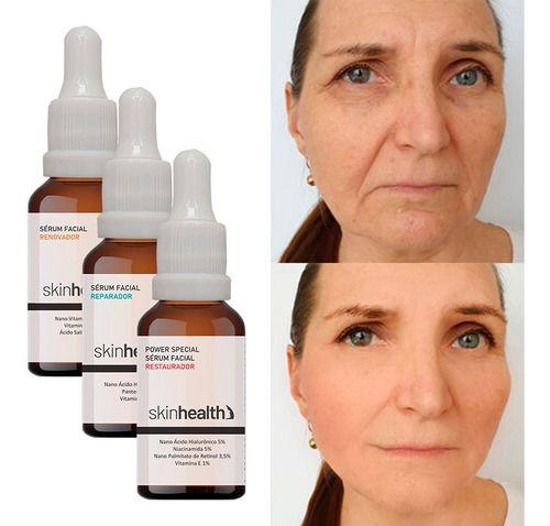 Kit Antirrugas Age Na Pele Reduzindo Rugas E Linhas 3 Séruns ...