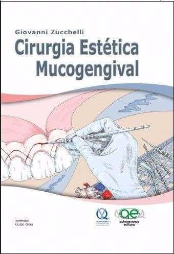 Livro Cirurgia Estética Mucogengival Giovanni Zucchelli - Napoleão ...