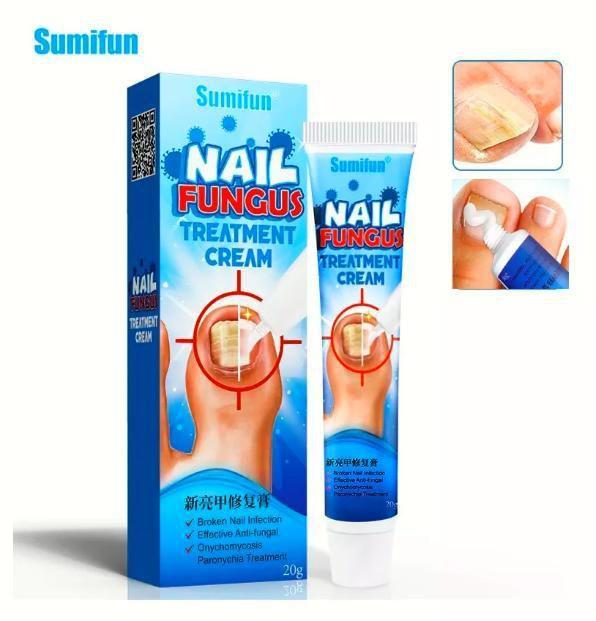 Pomada Reparo de Unha Micose Fungo - 30g - Sumifun - Tratamento para as ...