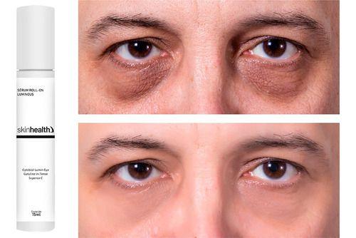 Sérum Roll On Reduz Olheiras E Bolsas Superox C 15ml Sh - Skinhealth ...