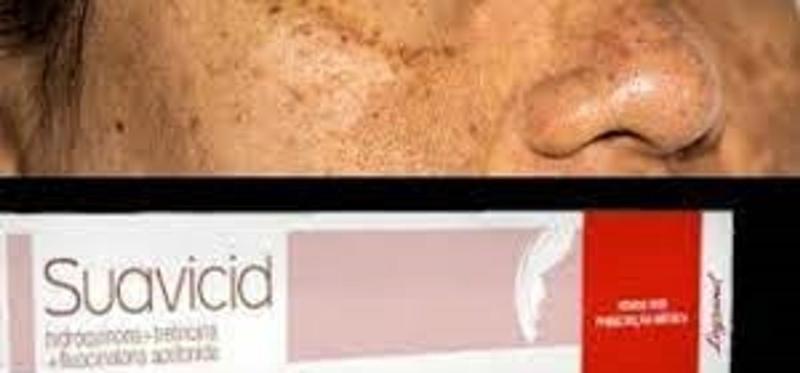 Suavicid Creme clareador (reduz manchas, oleosidade, linhas de ...