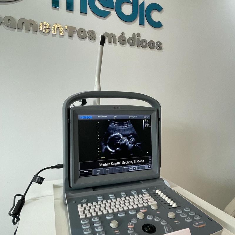 ULTRASSOM HIPERMEDIC HUMANO ECO2 COM DOPPLER PULSADO e POWER DOPPLER ...